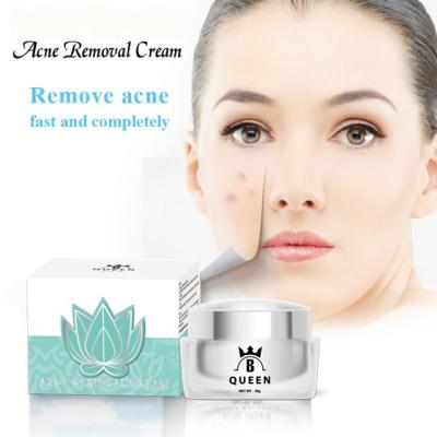 China Skin Care Day and Night Cream for Dark Spot Acne Removing for sale