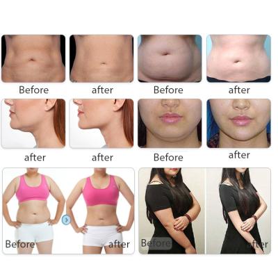 Cina Macchina di congelamento grassa di rf Cryolipolysis 800W, macchina grassa multifunzionale di perdita in vendita