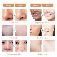 China Multifunction Professional Oxygen Facial Machine 110v ,150AV Face Peeling Machine for sale