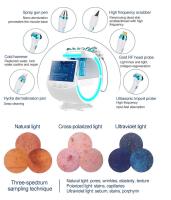 China Multifunction Professional Oxygen Facial Machine 110v ,150AV Face Peeling Machine for sale