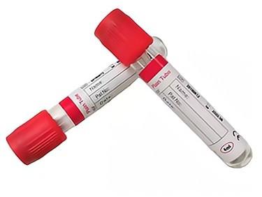 Cina Disposable Medical Vacuum Blood Collection Tube CE ISO in vendita