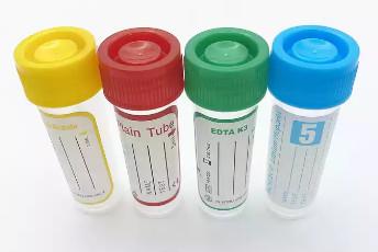 Cina Provette mediche per la raccolta di campioni di sangue sottovuoto monouso in vendita