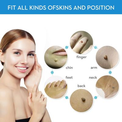 Cina Chiaro ODM automatico tenuto in mano di Kit Stopping Skin Tags Blood del dispositivo di rimozione dell'etichetta della pelle in vendita