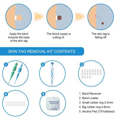 Cina Chiaro ODM automatico tenuto in mano di Kit Stopping Skin Tags Blood del dispositivo di rimozione dell'etichetta della pelle in vendita