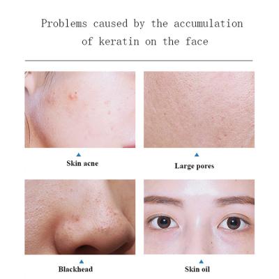 Cina 2 in 1 diamante domestico della pelle dell'attrezzatura del salone di bellezza della macchina di Dermabrasion della hydra di uso in vendita