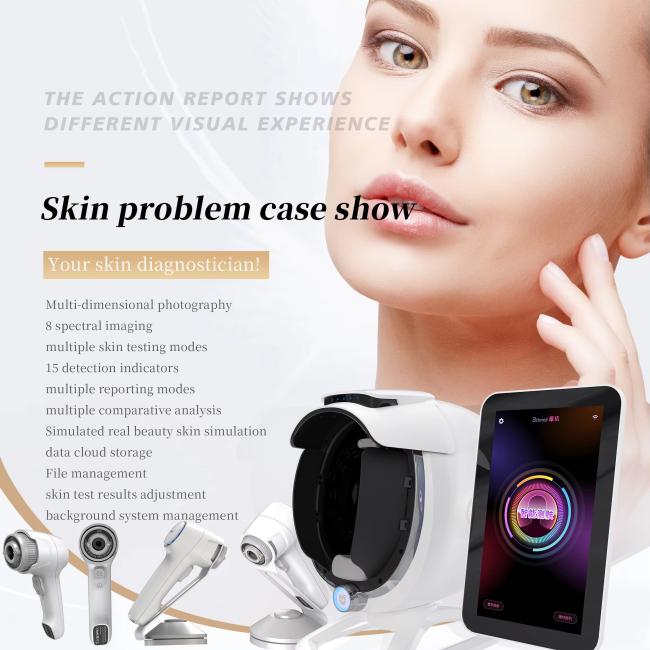 3d Ai Face Skin Diagnostics Analyzer Facial Tester Scanner Face Mirror Device Skin Analysis Machine Bitmoji Skin Analyzer