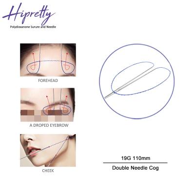 China Hipretty face lifting therapy lift treatment mono smooth double needle molding 18 G threads cog barbed suture pdo thread for sale