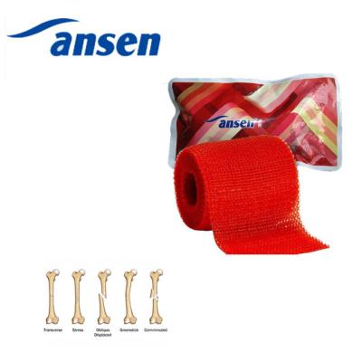 China Hospital patient-friendly hot sale ortopedic casting tape products for sale