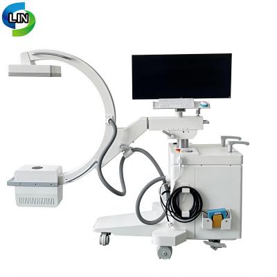 China Mobile C-arm X-ray System with 40kV-125kV Voltage Range, Flat Panel Detector, and 30 fps Frame Rate for Operating Room for sale