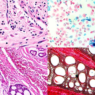 China LED 40-1000x Forschung Trinocular-Labormikroskop des Mittel-optisches Mikroskop-A12.2603 biologisches zu verkaufen