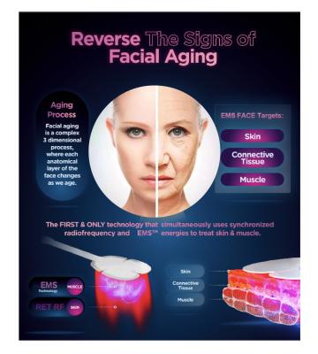 China EMS Tecnologia Máquina de remoção de rugas de rosto em V Anti envelhecimento para aperto facial portátil à venda