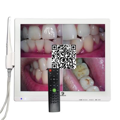 China Auto Focus Intraoral Camera Including MP4 Video Format and JPEG Image Format Supporting Comprehensive Dental Diagnostics for sale