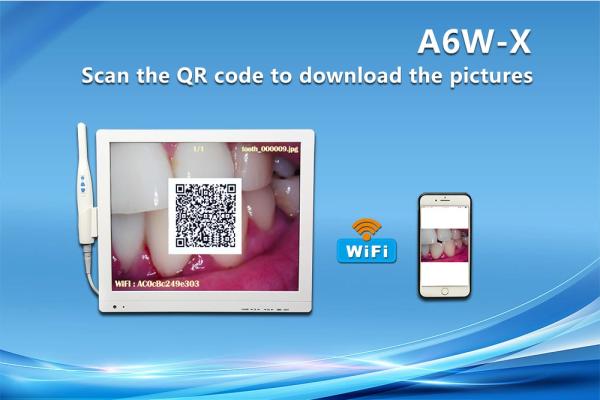 Quality 17 Inch HD Dental Intraoral Camera Multimedia Oral Viewer, Clear Imaging Video Recording, QR Code One-Click Image Transfer to Mobile Phone, Factory Direct Supply Low Cost for sale