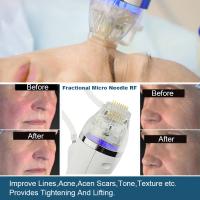 China Skin Tightening RF Microneedling Machine for sale