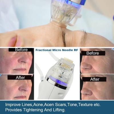 China Radiofrequência fracionária e micro-agulha Rf máquina de ouro Microneedling pele de levantamento e aperto de equipamentos à venda