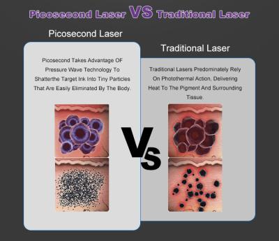Cina Super Picosecond Picolaser Tattoo Remover Q Switched Pico Seconda macchina laser di rimozione del tatuaggio in vendita