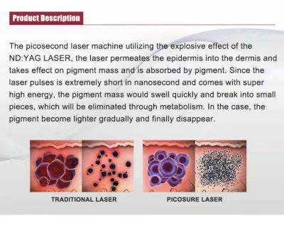 China Máquina portátil de remoción de tatuajes Pico Segundo Laser Q Switch Nd Yag Picosecond en venta