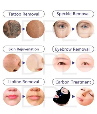 China Máquina portátil de eliminación de tatuajes con láser de Pico. en venta