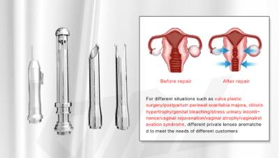 Cina Dispositivo di ringiovanimento vaginale a radiofrequenza frazionato laser 360 RF in vendita