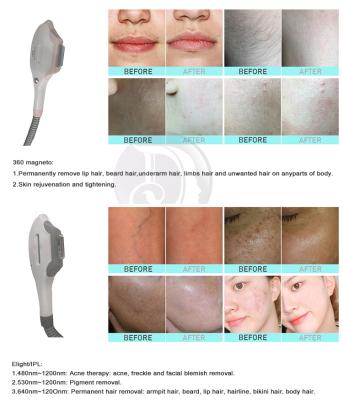 China Multifunctionele 4 in 1 Elight ipl opt rf nd Yag Laser Tattoo Removal IPL Haarverwijdering Schoonheidsmachine Te koop