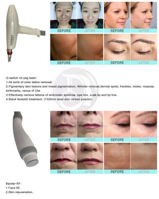 China Multifunctionele 4 in 1 Elight ipl opt rf nd Yag Laser Tattoo Removal IPL Haarverwijdering Schoonheidsmachine Te koop