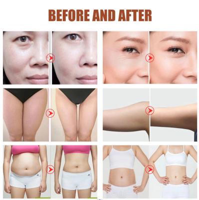 Cina Sistema di cavitazione a vuoto del grasso Liposuczione 40k 80k Cavitazione Slimming Machine RF Radio Frequency Skin Body Beauty Health Machine in vendita