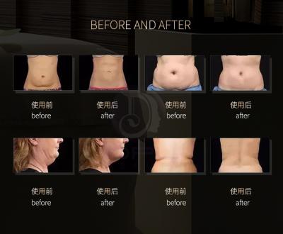 Cina La più recente macchina per stringere la pelle a radiofrequenza con sistema di cavitazione da 80K in vendita