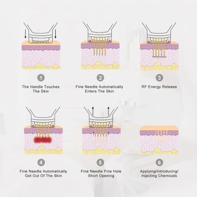 Cina Macchine per il microneedling in oro RF Strumento portatile per il ringiovanimento della pelle Produttore di attrezzature per la bellezza in vendita