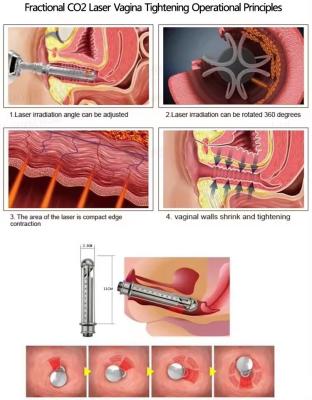 China SV8 Tubos portáteis de RF Laser Fracionado de CO2 60W Laser Fracionado de CO2 Vaginal Tightening Machine Laser de CO2 para pele à venda