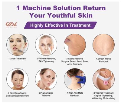 Cina ZGV13-02 Fractional CO2 RF Tube laser machine Private Laser black color salon beauty machine in vendita