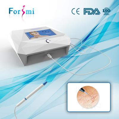China Best price 30M Hz 150W RBS Spider Veins Removal Equipments for promotion for sale