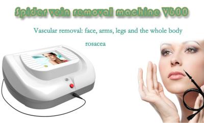 China RBS 30MHZ high frequency facial skin veins removal skin tag removal machine for sale