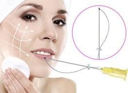China hot sales plastic surgery PDO COG lifting for V face and chest lifting for sale