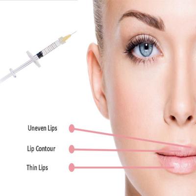 China new feeling 2ml facial HA filler/ derma filler/hyaluronic acid dermal filler injection for sale
