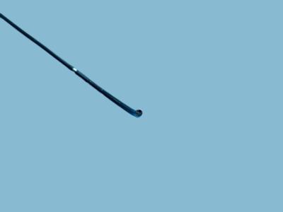 China URF-V2 High Definition Video Ureteroscope With 80 Degrees Field Of View Medical Endoscope for sale