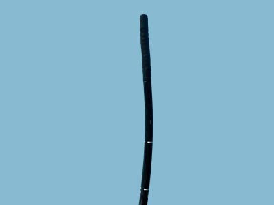 Cina Endoscopio medico avanzato GIF-Q150 da 1030 mm per procedure gastrointestinali superiori in vendita