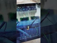 Proef-fout om de belemmering met een laser te overwinnen