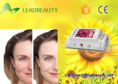 China Medical CE approved high frequency skin tag millia warts fat granule laser spider vein removal beauty machine for sale