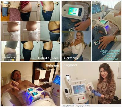 China Body Weight Loss Sculpting Slimming Freeze Fat 4 handles cryolipolysis body slimming weight loss for sale