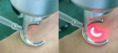 Cina Macchina frazionaria Vaginal Skin Rejuvenation Laser Machine del laser di CO2 dell'erbio di dermatologia in vendita