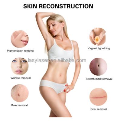 Cina Macchina frazionaria Vaginal Skin Rejuvenation Laser Machine del laser di CO2 dell'erbio di dermatologia in vendita
