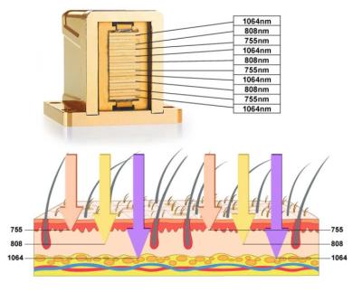 Cina il diodo rf di depilazione del laser di 755nm 1064nm DPL pela il rafforzamento del dispositivo in vendita