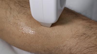 Cina Macchina di depilazione del laser a diodi dell'alessandrite in vendita
