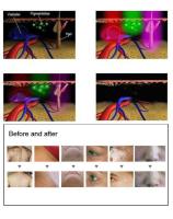 China Microblading Q Switch Nd Yag Laser for sale