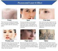 China Nd Yag Laser Tattoo Removal Machine for sale