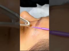 Macchina del laser dei capelli del laser 110v IPL di Elight IPL rf del siero del salone