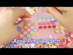 diamond hydrocolloid acne pimple patch removing pimples facial care oem design