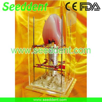 China SHOW-case big implant for sale