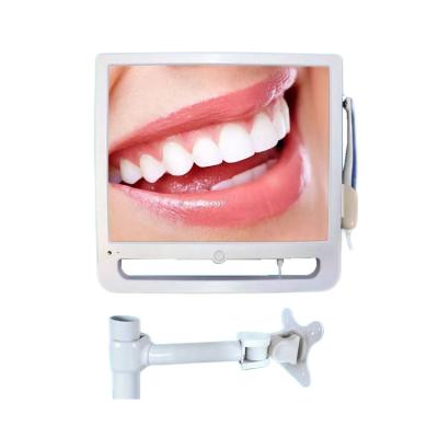 China 17 Inch Dental Intra Oral Endoscope Intra Camera and Metal Holder for dental Clinic/Dental intra oral camera with WIFI for sale