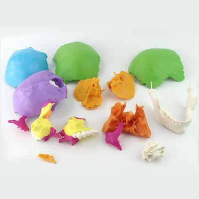 Cina Cranio umano disarticolato 22 parti Cranio Modello, Cranio umano esploso Modello Osso adulto Colore Grandezza naturale in vendita